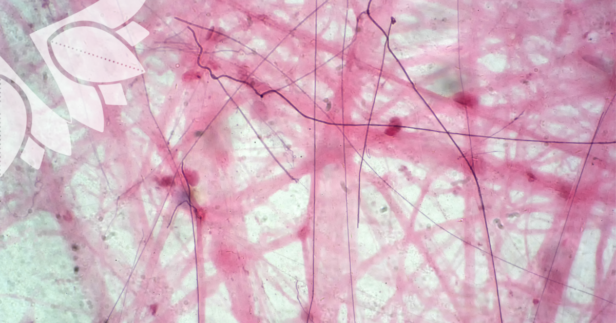 Wat is Bindweefsel ( Fascia)?